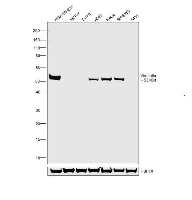 Vimentin Monoclonal Antibody (V9) (14-9897-82)