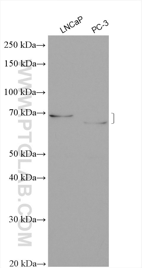 ST6GALNAC1 Polyclonal Antibody (15363-1-AP)