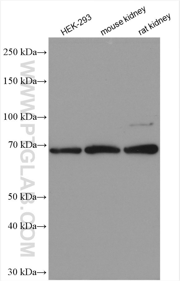 HEXB Polyclonal Antibody (16229-1-AP)