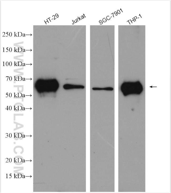 RIP3 Polyclonal Antibody (17563-1-AP)