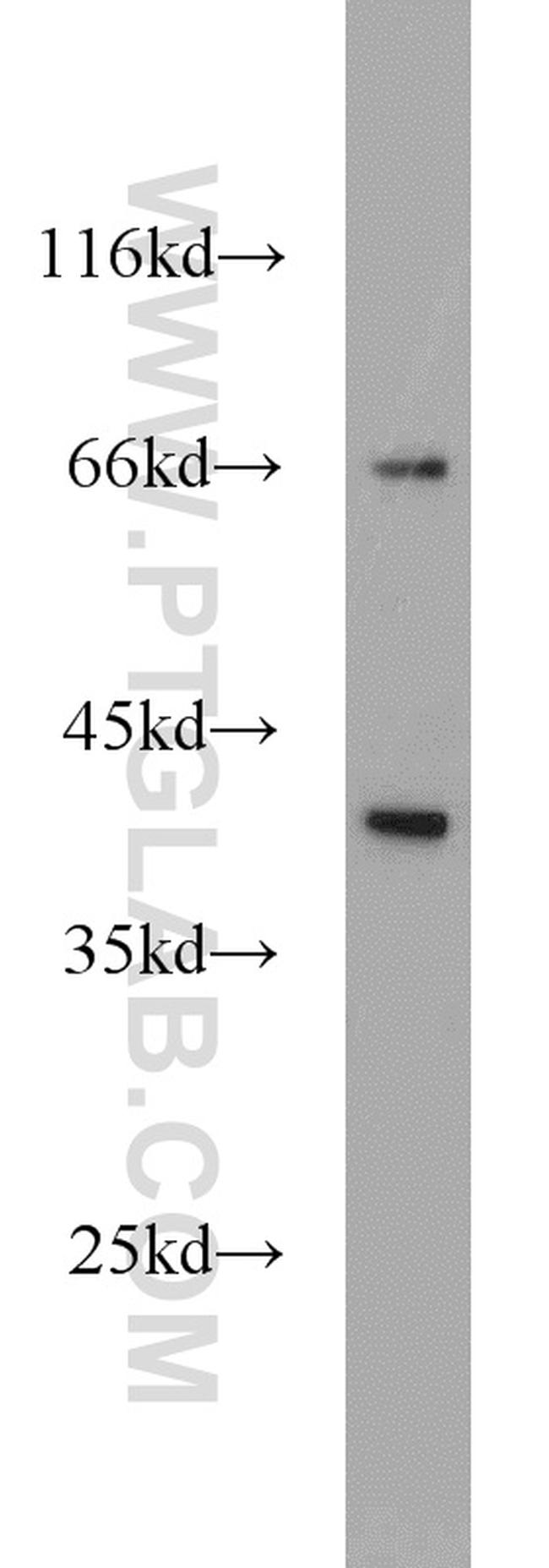 ARL13B Antibody (17711-1-AP)
