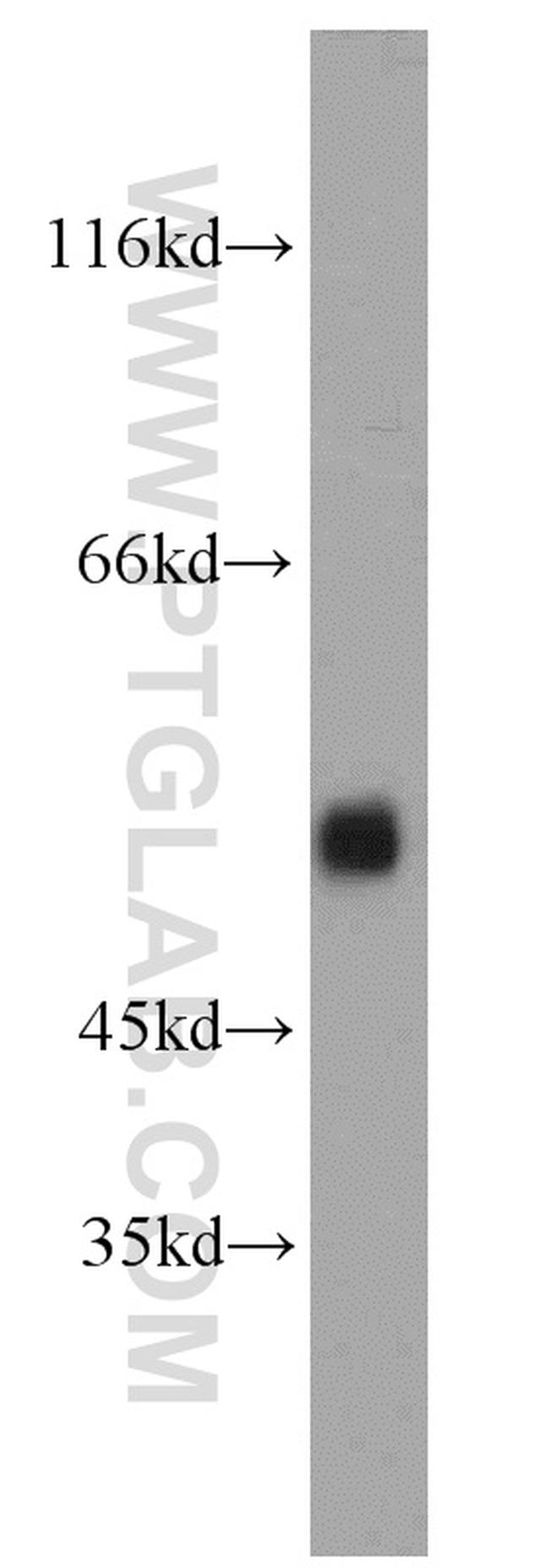 ARL13B Antibody (17711-1-AP)