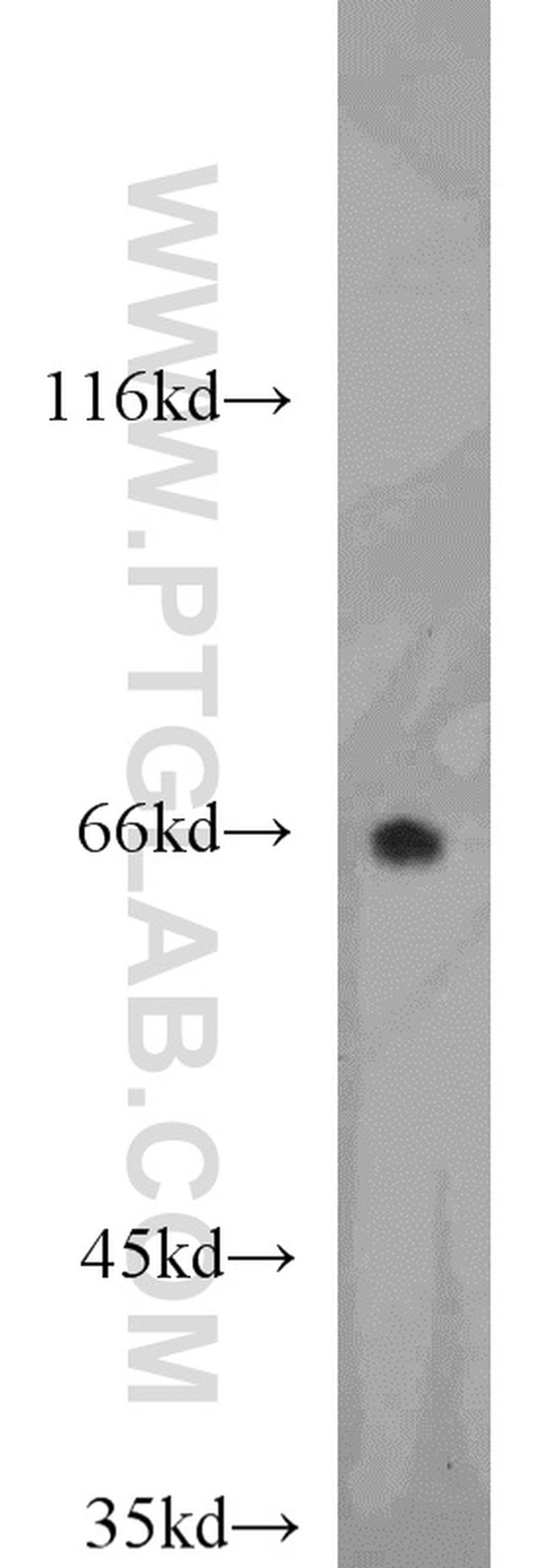 ARL13B Antibody (17711-1-AP)
