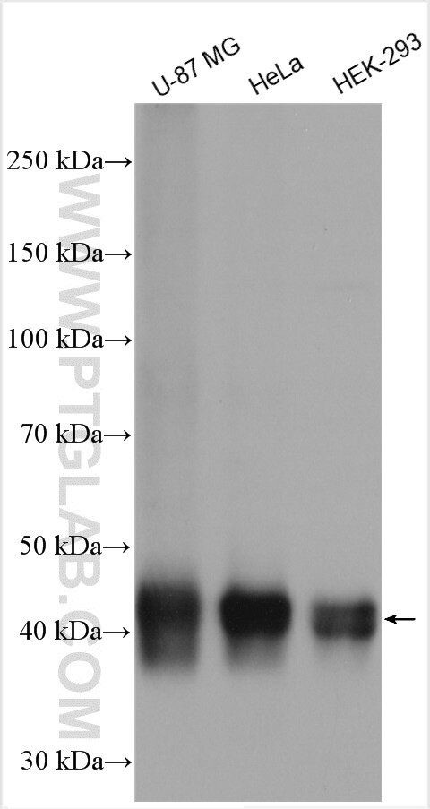 GPR177 Polyclonal Antibody (17950-1-AP)