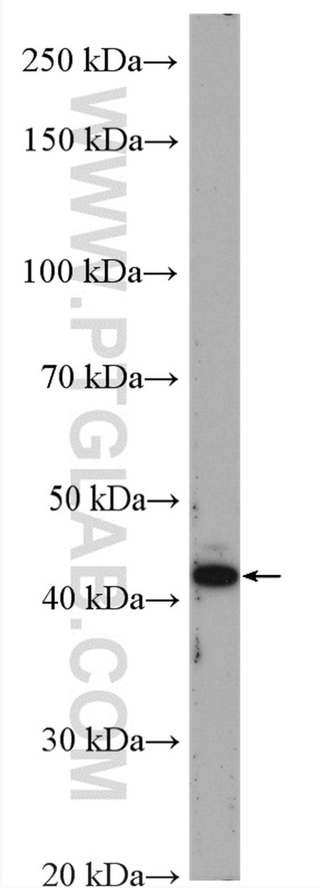 VEGF Antibody (19003-1-AP)