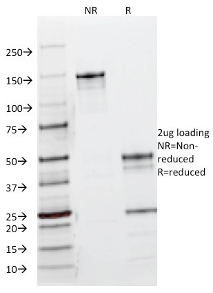 EGFR (Epidermal Growth Factor Receptor) Monoclonal Antibody (B1D8) (1956-MSM2-P1ABX)