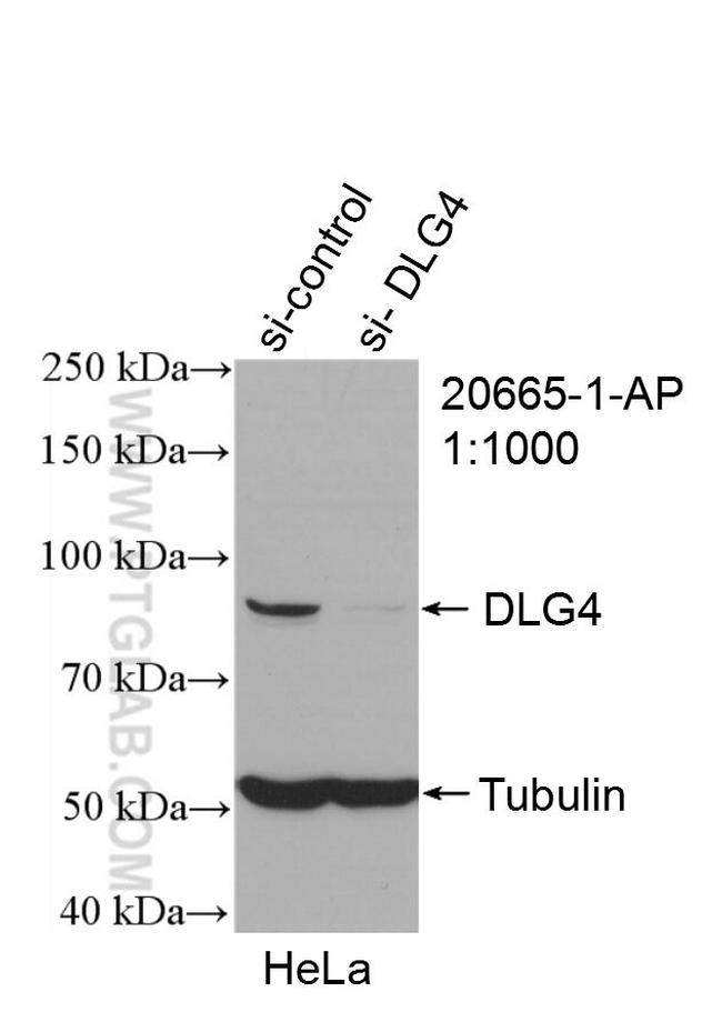 PSD95/DLG4 Antibody (20665-1-AP)