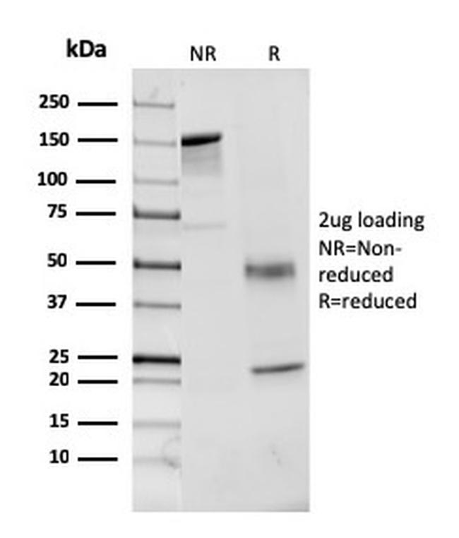 Coagulation Factor VII/F7 Antibody (2155-MSM3-P1)