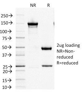 Factor XIIIa (Coagulation Factor XIIIA Chain) Monoclonal Antibody ...