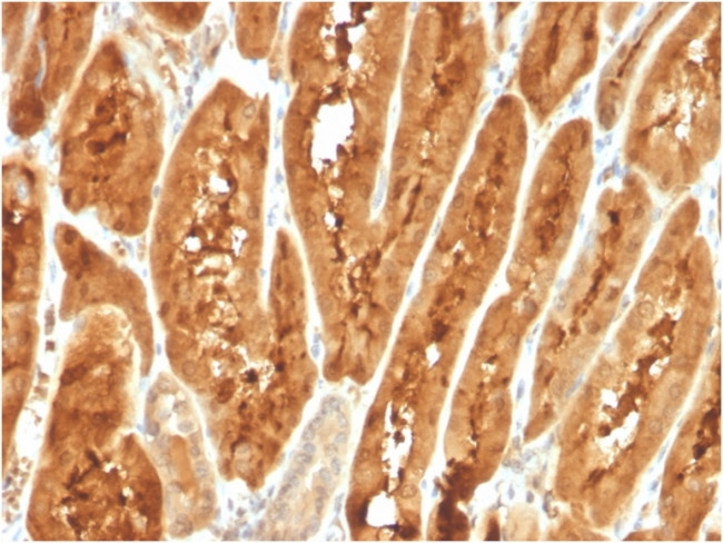 Fatty Acid Binding Protein (Liver)/FABP1 Antibody (2168-MSM7-P1ABX)