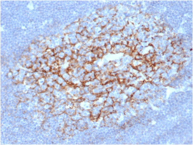 CD23 (Fc Epsilon RII) Monoclonal Antibody (FCER2/6892) (2208-MSM12-P1)