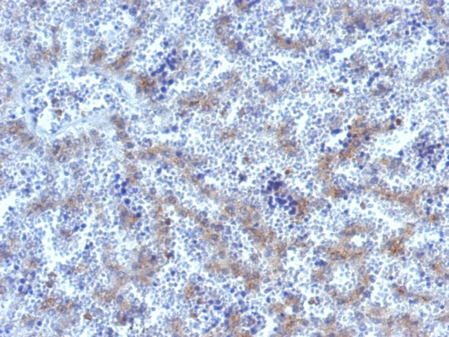 Glypican-3 (GPC3) (Hepatocellular Carcinoma Marker) Polyclonal Antibody ...