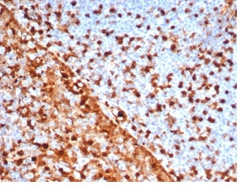 Annexin A1/(Hairy Cell Leukemia Marker) Antibody (301-MSM11-P1)