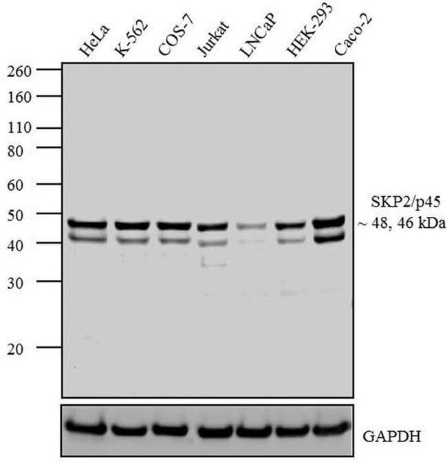 SKP2 Monoclonal Antibody (SKP2-8D9) (32-3300)