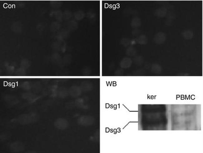 Desmoglein 3 Antibody (32-6300)