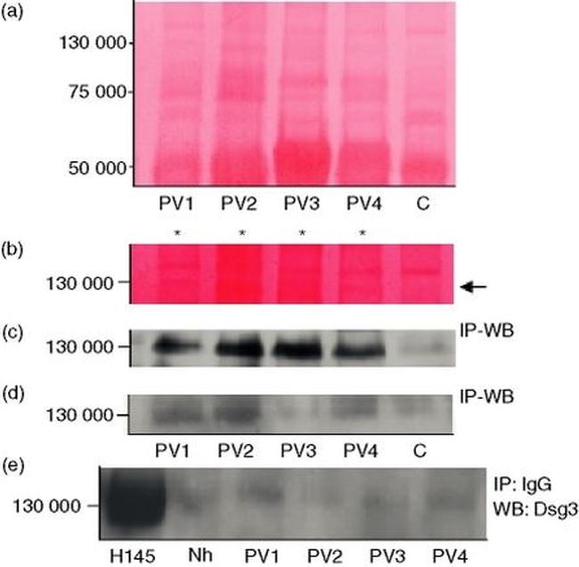 Desmoglein 3 Antibody (32-6300)