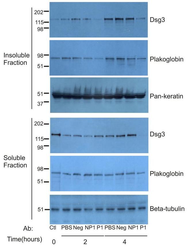 Desmoglein 3 Antibody (32-6300)