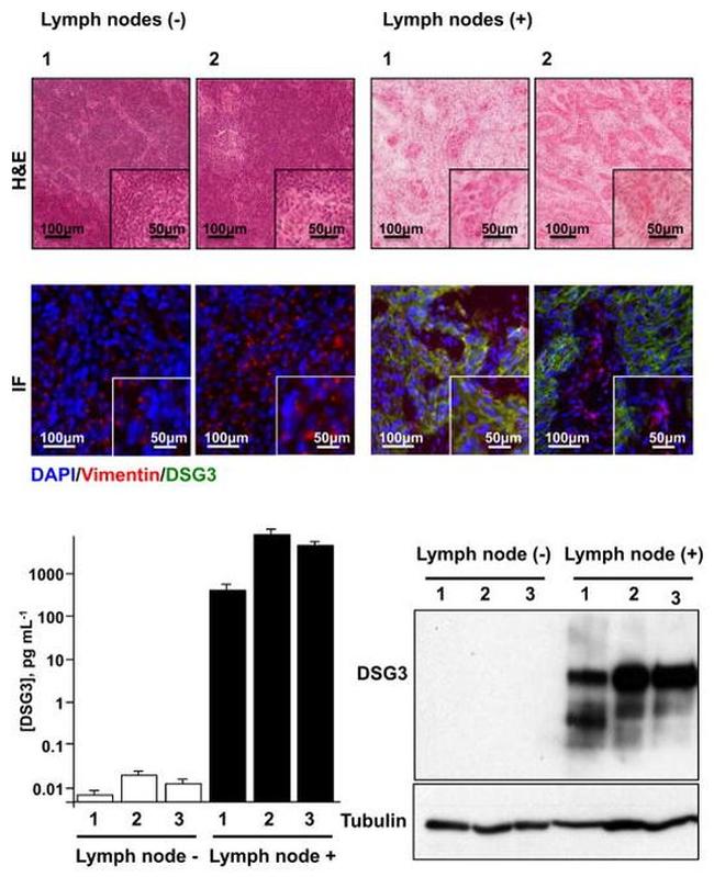 Desmoglein 3 Antibody (32-6300)