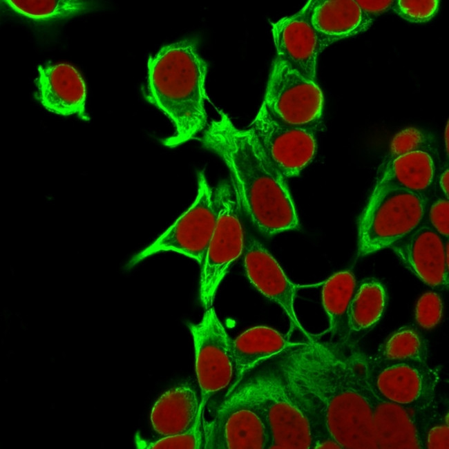 Cytokeratin 18 (KRT18) Monoclonal Antibody (KRT18/835) (3875-MSM5-P1ABX)