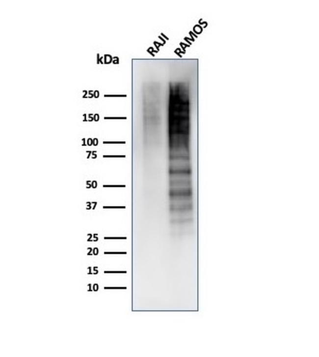 Ki-67 Recombinant Monoclonal Antibody (MKI67, 4945R) (4288-RBM15-P1ABX)