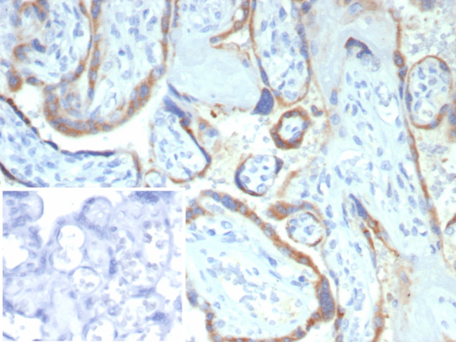 MMP2/Collagenase Type IV A (Tumor Metastasis Marker) Monoclonal ...