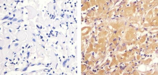 Phospho-Zap-70 (Tyr292) Antibody (44-230G)