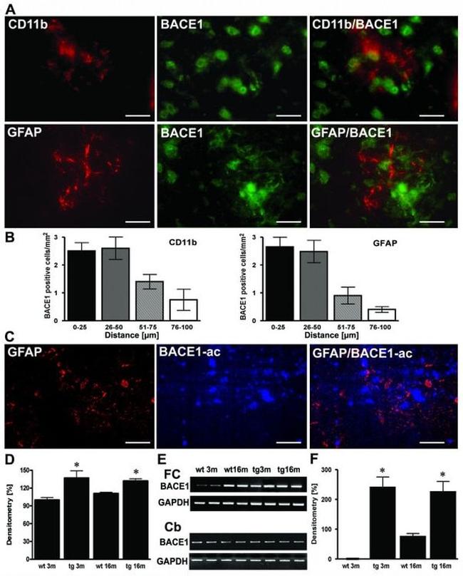 beta Amyloid (1-42) Antibody (44-344)