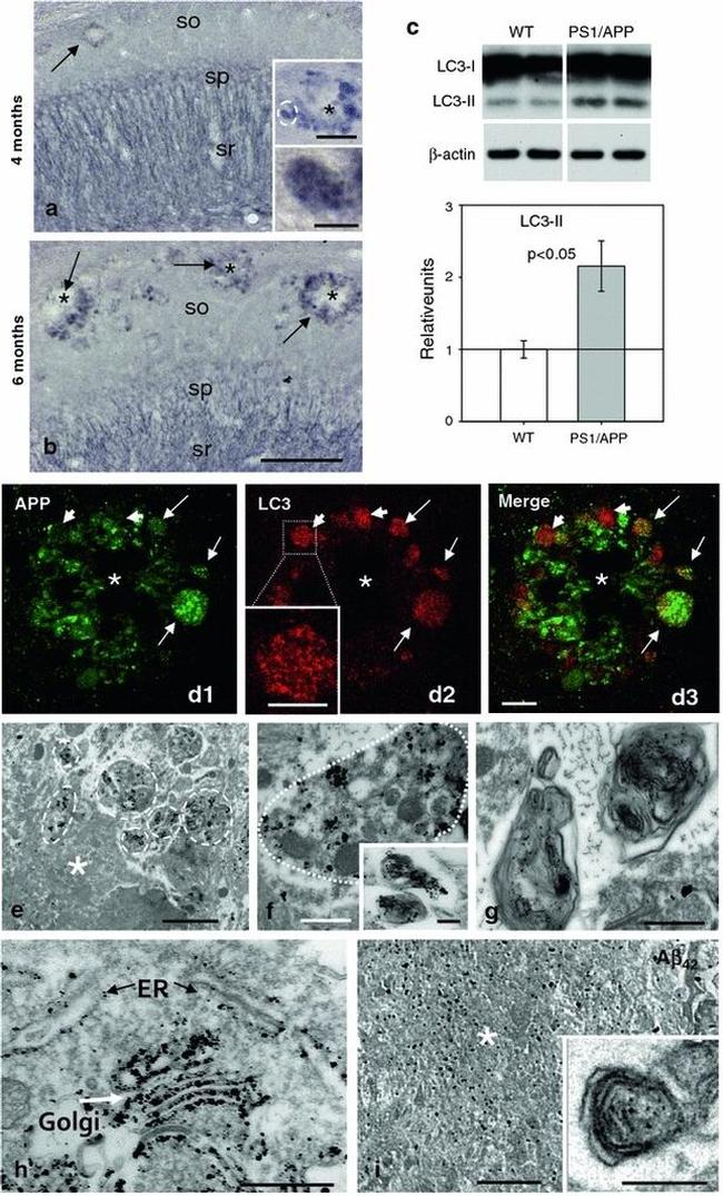 beta Amyloid (1-42) Antibody (44-344)