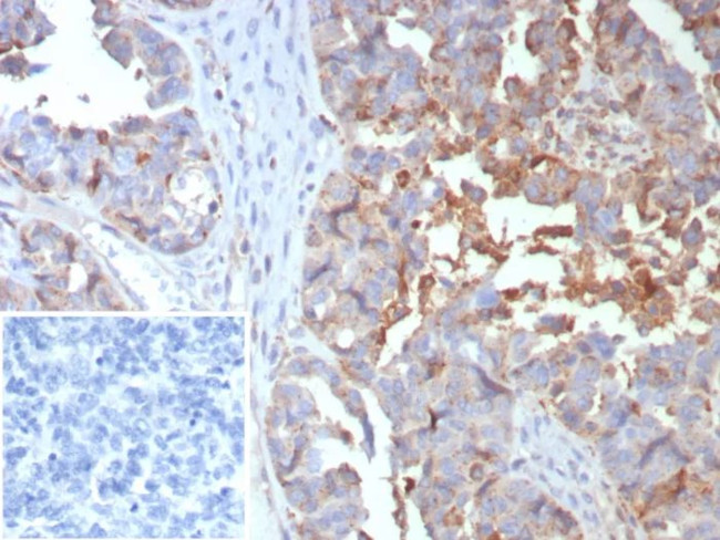 MX1/MX dynamin like GTPase 1 Monoclonal Antibody (MX1/7529) (4599-MSM4 ...