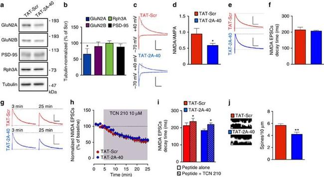 NMDAR2A Antibody (480031)