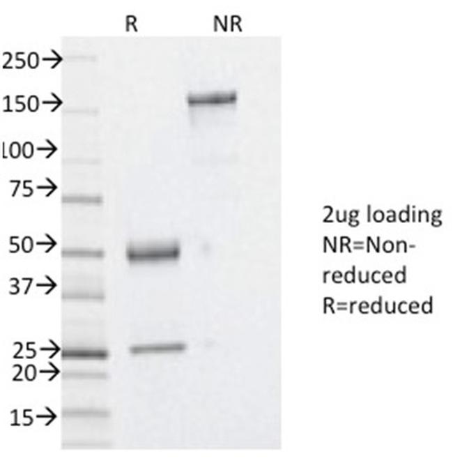 YBX1/Y-box Binding Protein 1/YB-1 Antibody (4904-MSM2-P1)