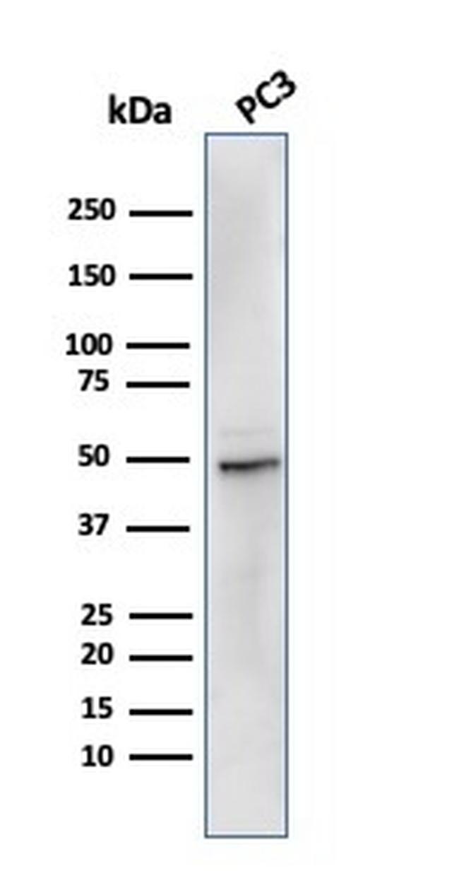 Ornithine Decarboxylase-1 (ODC-1) Antibody (4953-MSM5-P1ABX)