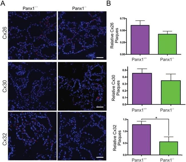 Connexin 26 Antibody (51-2800)