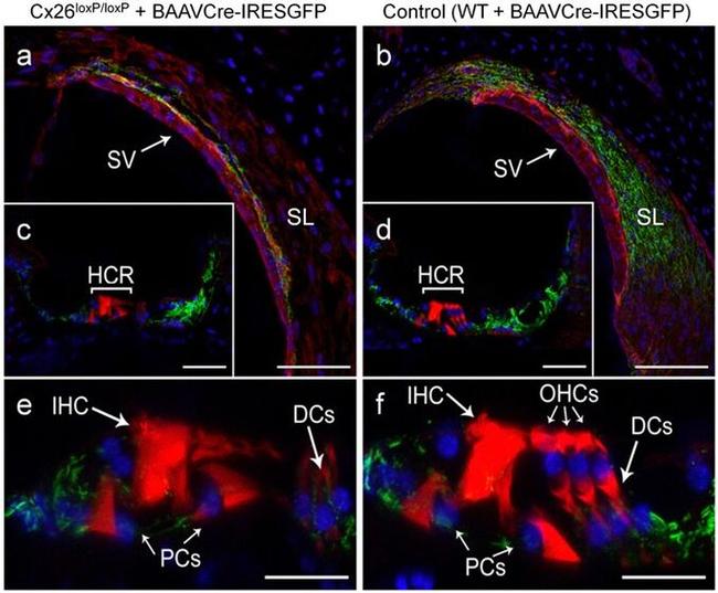 Connexin 26 Antibody (51-2800)