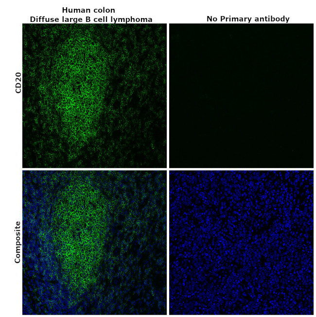 CD20 Monoclonal Antibody (L26), Alexa Fluor™ 488 (53-0202-82)