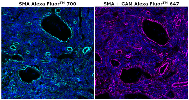 Alpha-Smooth Muscle Actin Monoclonal Antibody (1A4), Alexa Fluor™ 700 (56-9760-82)