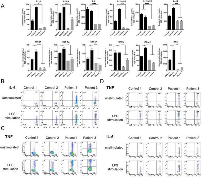 IL-6 Antibody (14-7069-81)