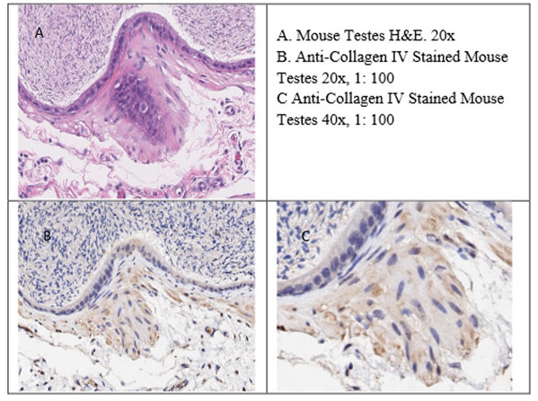 Collagen Type IV Polyclonal Antibody (600-101-MN4)