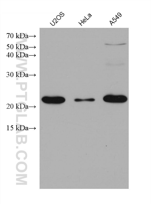 IL18 Monoclonal Antibody (5C6F8) (60070-1-IG)