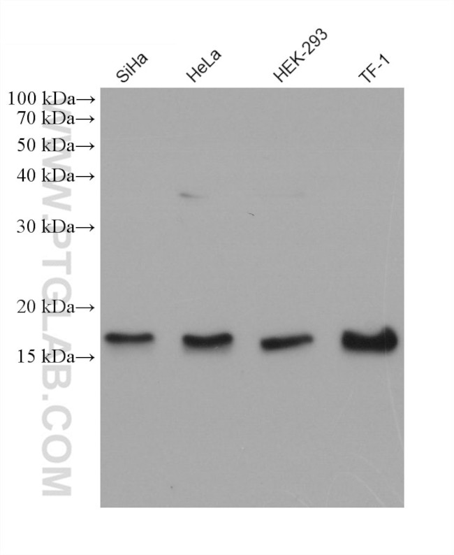 Phospho-PERK/EIF2AK3 (Ser719) Monoclonal Antibody (3H7A11) (60597-1-IG)
