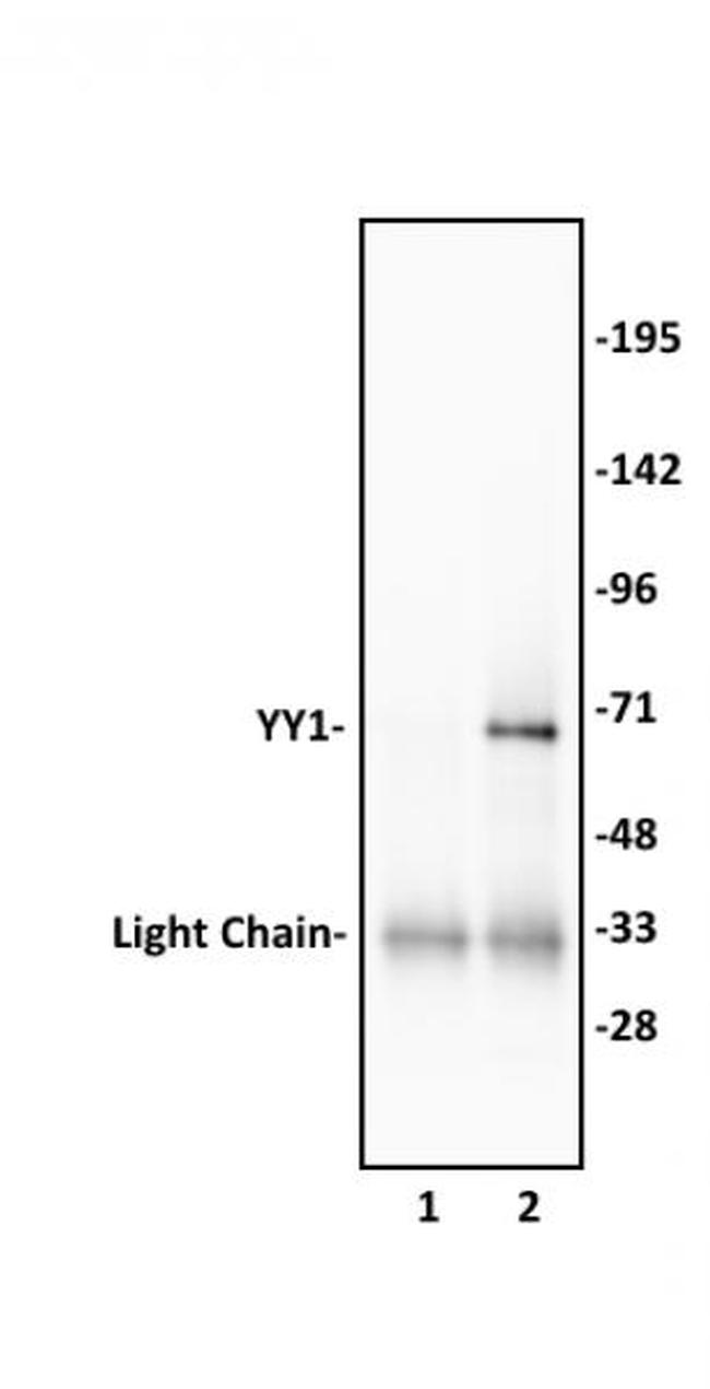 YY1 Polyclonal Antibody (61779)