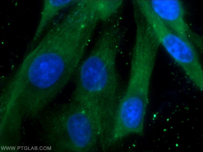 alpha Tubulin Antibody (66031-1-IG)