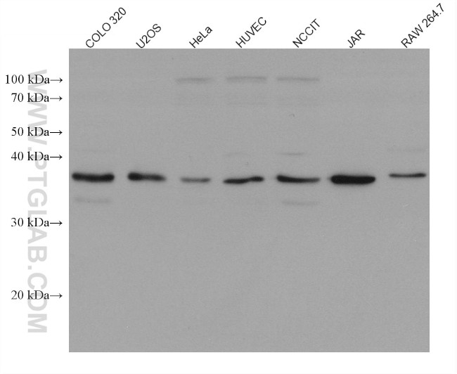 RANKL Monoclonal Antibody (3F2E1) (66610-1-IG)