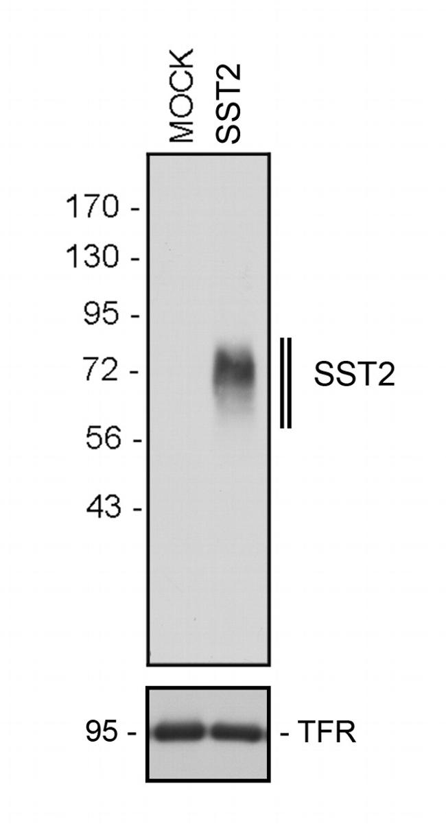 SSTR2 Antibody (704011)
