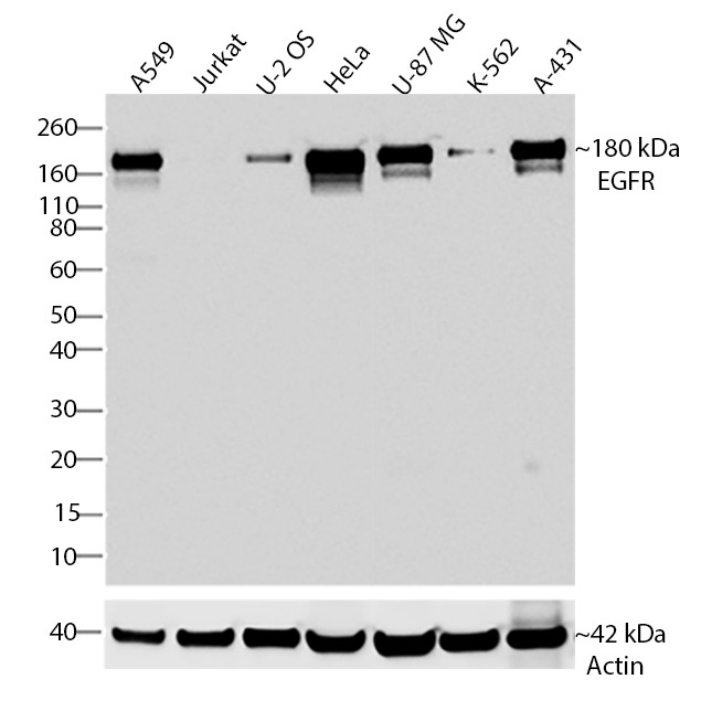 EGFR Antibody (700308)