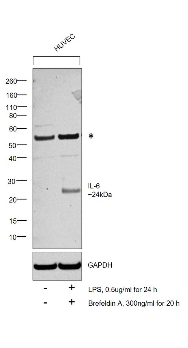 IL-6 Antibody (701028)
