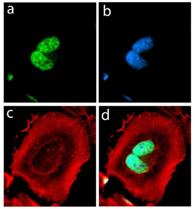 alpha Synuclein Antibody (701085)