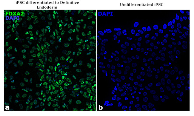 FOXA2 Antibody (701698)