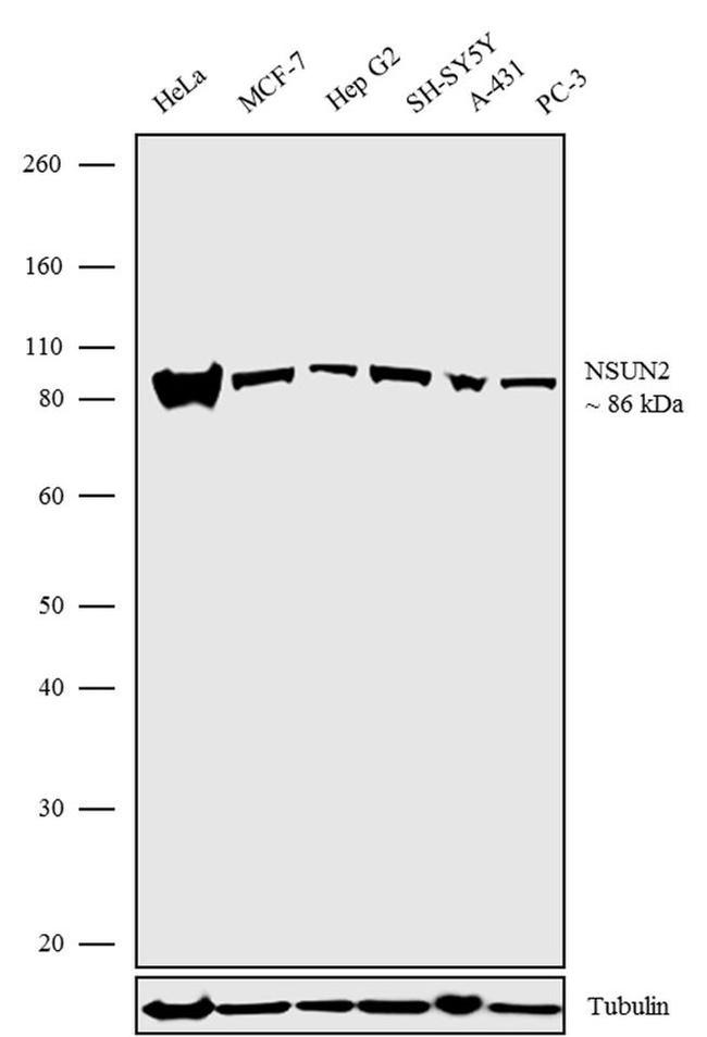 NSUN2 Recombinant Monoclonal Antibody (3H24L11) (702036)