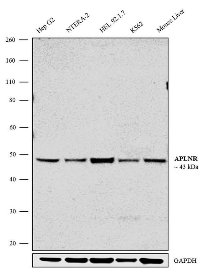 Apelin Receptor Antibody (702069)